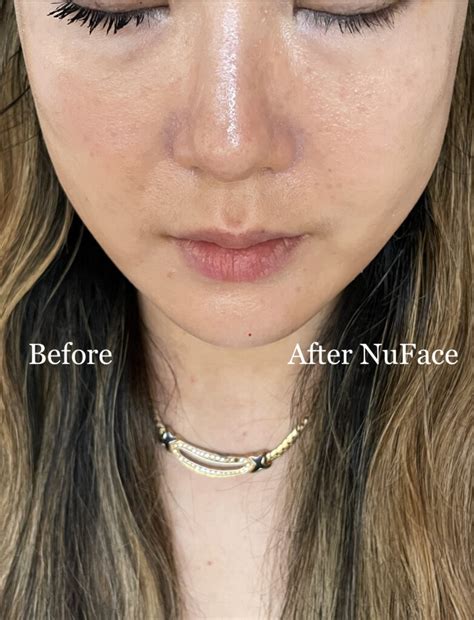 My Brutally Honest Nuface Review After 5 Years Organic Beauty Lover