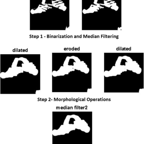 Filtering And Morphological Operations Download Scientific Diagram