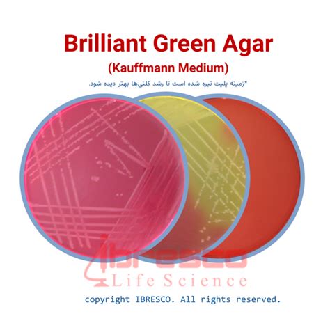 Brilliant Green Agar Composition Principle Preparation 49 Off