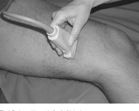 Figure 1 From Ultrasound Guided Infrapatellar Nerve Block In Human Volunteers Description Of A