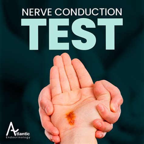 👉nerve Conduction Testing Also Atlantic Endocrinology
