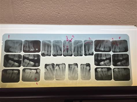 Rad Practical Example 1 Diagram Quizlet