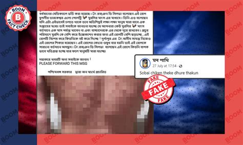 Old Photo Of Chicken Pox Patient Revived With Fake Morphin Virus In