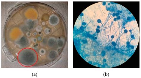 Aspergillus Culture