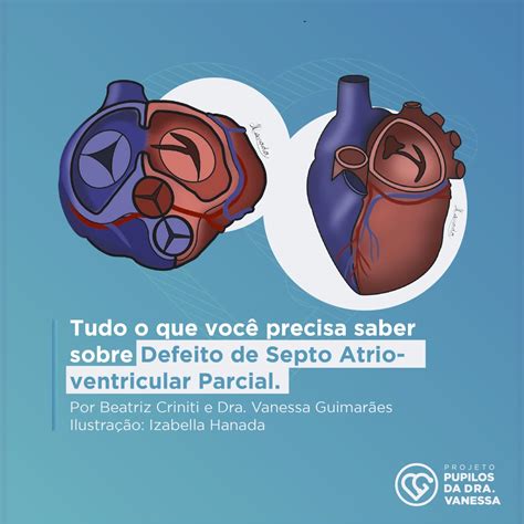Tudo O Que Você Precisa Saber Sobre Defeito De Septo Atrio Ventricular