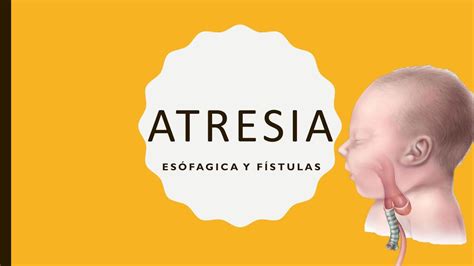Atresia Adriana Udocz