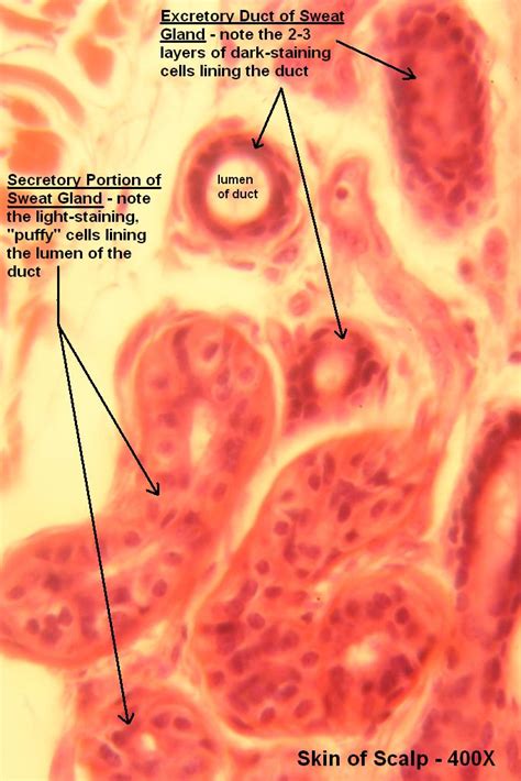 Human Scalp Under Microscope Labeled