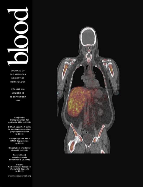 Proteomic Cell Surface Phenotyping Of Differentiating Acute Myeloid