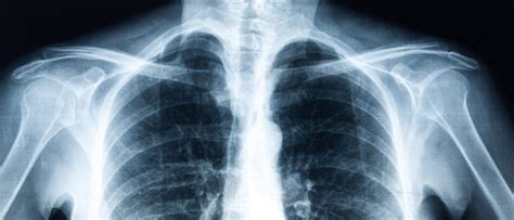 Digital To Film Services Ebeam Imaging