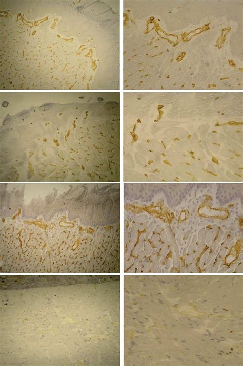 Cd31 Staining Confirms The Early Induction Of Vascular Lesions In The