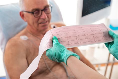 Electrocardiogram Ecg Basics Gpex