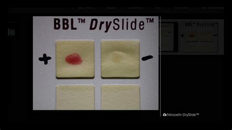 Nitrocefin Dryslide Microbiology Youtube