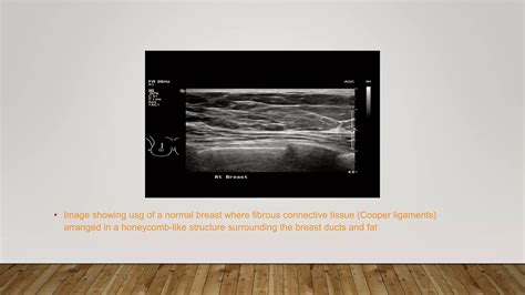 Birads Classification Of Breastpptx