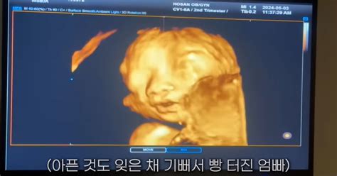 강재준♥ 이은형 임당검사서 저혈당 쇼크죽다 살았다 기유tv 종합