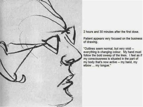 Bayu Purnomo Zone 2 Apa Itu Lsd Dan Apa Bahaya Lsd