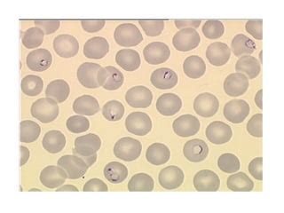 Different Types Of The Blood Parasites 2ppt