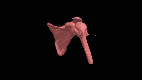 Vishal Desai 3d Model By Medimax Advance Radio Imaging