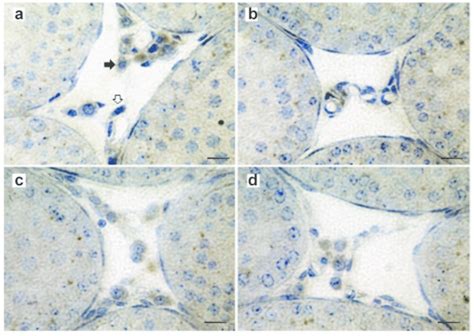 Effects Of Hormonal Treatment On Rat Interstitial Morphology There