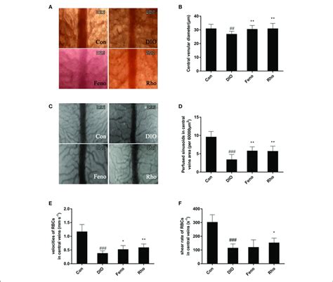 Effects Of Rho On Hepatic Microcirculation Disturbances In Dio Mice Download Scientific