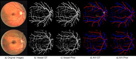 Figure 2 From Fully Automated Tree Topology Estimation And Artery Vein