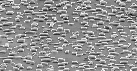 Electron Microscopy Biomedical Electron Microscopy Unit University