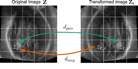 Figure 3 From Prototype Learning For Explainable Regression Semantic Scholar
