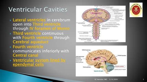 3rd And Lateral Ventricles Pdf Pdf