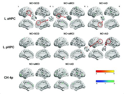 Between Group Nc Scd Nc Amci And Nc Ad Differences In Structural