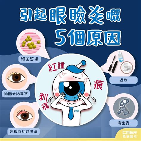 健康資訊 引起眼瞼炎嘅5個原因👆 希瑪眼科