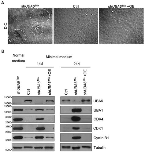 The Non Canonical Ubiquitin Activating Enzyme Uba6 Suppresses