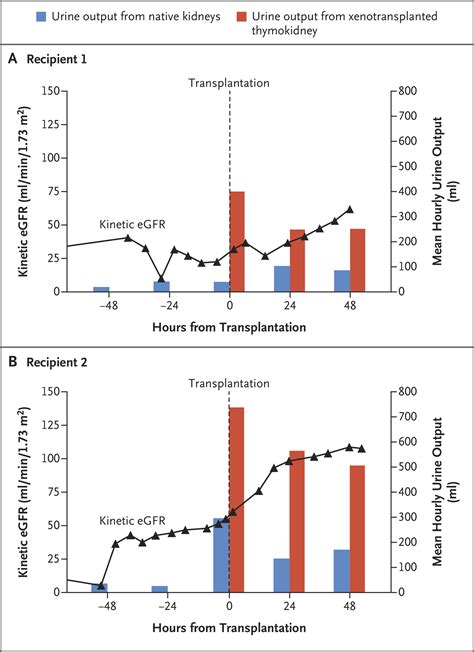 Results of Two Cases of Pig-to-Human Kidney Xenotransplantation | NEJM