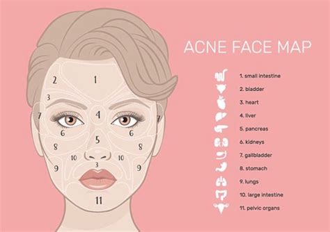 Acne Map And Your Health Face Mapping Pimples On Face Acne Face Wash