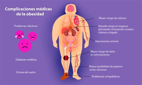 Unadm Saludable Comer Saludable ¿qué Sucede Si No Te Alimentas Bien