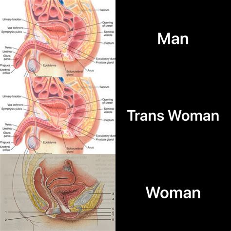 Transgender Anatomy Diagram