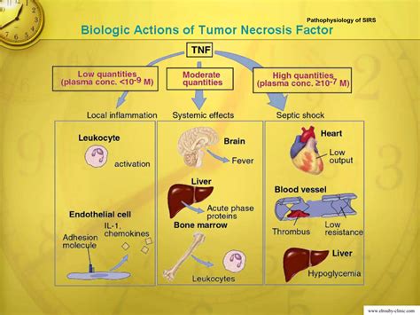 Systemic Inflammatory Response Syndrome Ppt