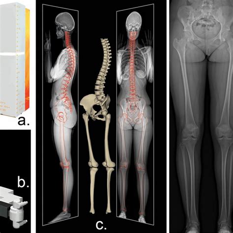 The Eos 2d3d Imaging System A The Eos 2d3d Imaging System And The
