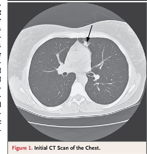 Figure 1 From Clinical Problem Solving A Recurrent Problem Semantic Scholar