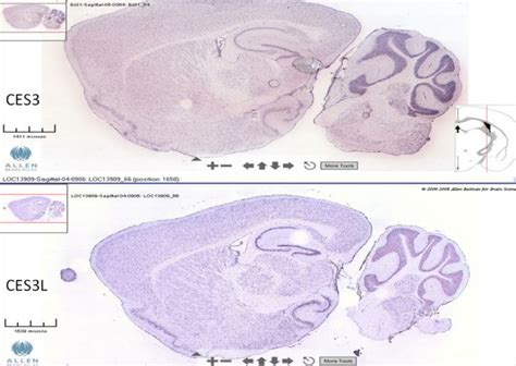 Mouse Brain Sagittal Section