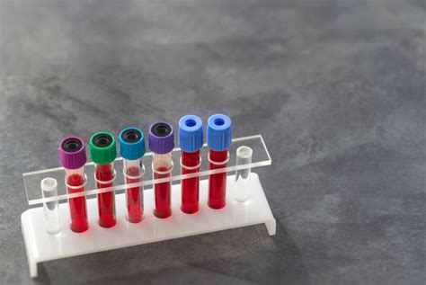 Health Benefits Of Colloidal Silver Health And Detox And Vitamins