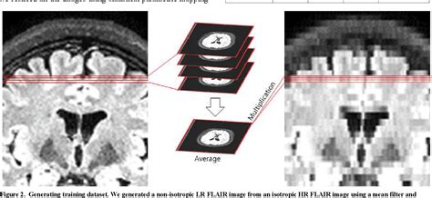 figure 2 from 3d super resolution for non isotropic medical image