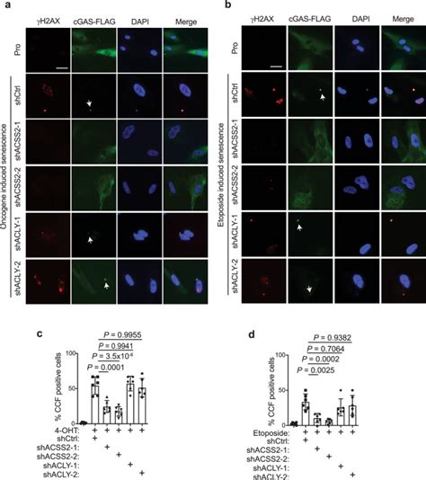 Acss2 Drives Senescence Associated Secretory Phenotype By Limiting