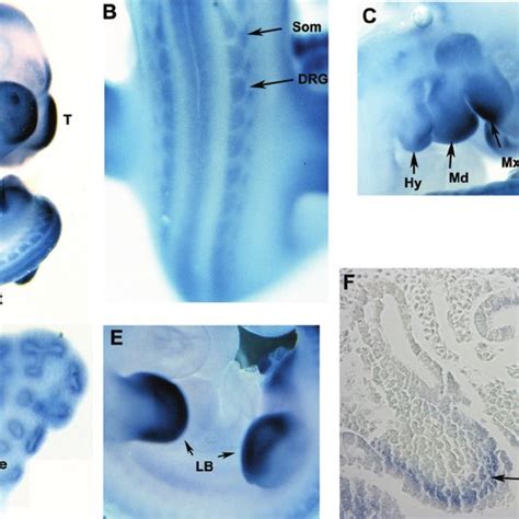Expression Profile Of N Myc At E105 Whole Mount In Situ