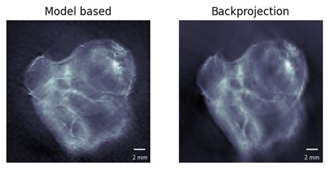 2 Comparing Image Reconstruction Methods — Patato Documentation