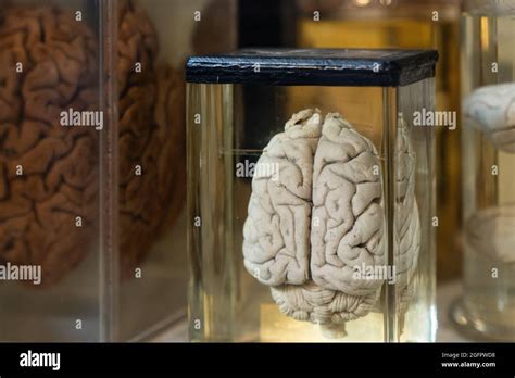 Preserved Brain
