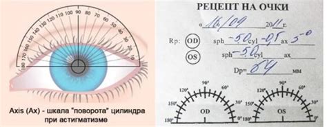 Очки при астигматизме: как правильно выбрать и стоит ли их носить ...
