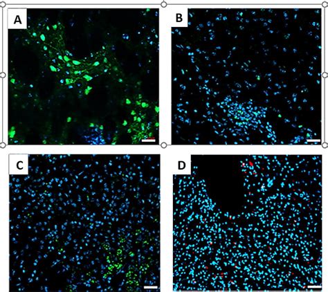 Lentivirus Vectors In Mouses Striatum Lentivirus Expression In The