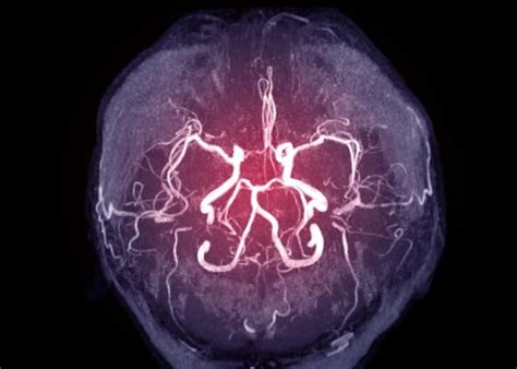 Le Cortex Auditif Primaire Du Cerveau Favorise Les Vocalisations Positives Provenant Du Côté Gauche