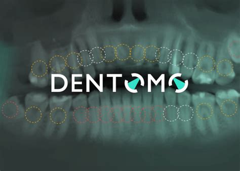Solutions Dentomo