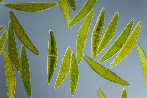 Microscopic Organism Desmidiaceae Chlorophytes Closterium Spec Stock