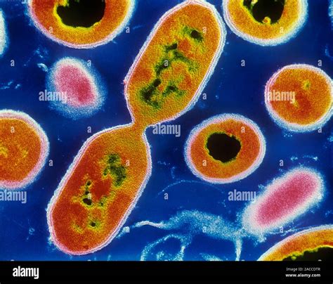 False Colour Transmission Electron Micrograph Tem Of A Colony Of